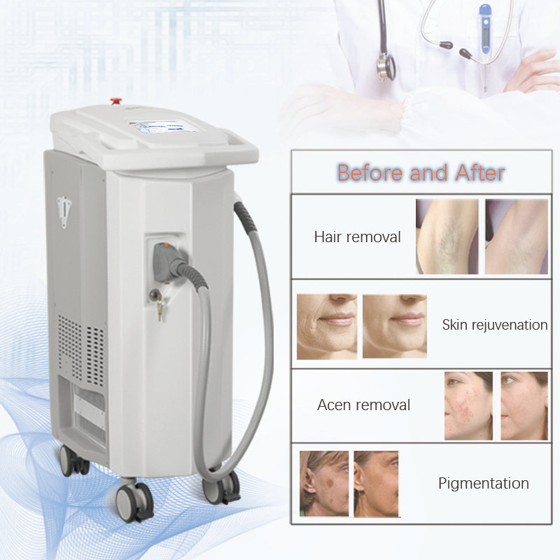 Long Pulse Professional Multiplatform Fractional Laser from China ...